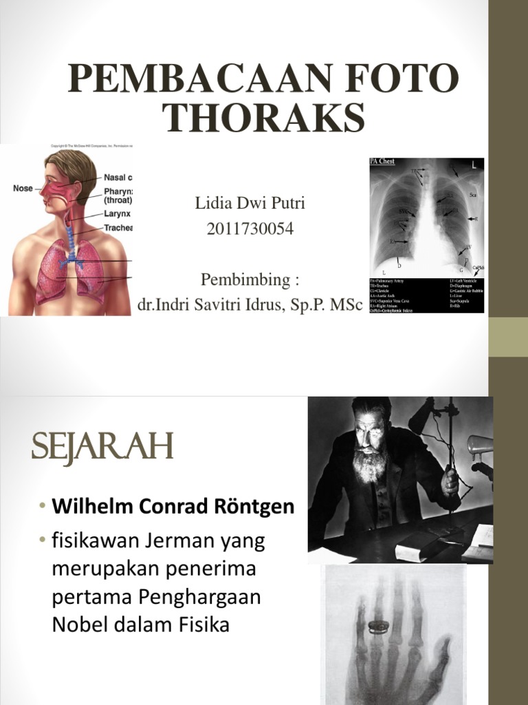 Rontgen Thoraks Refreshing Dr. Indri | PDF