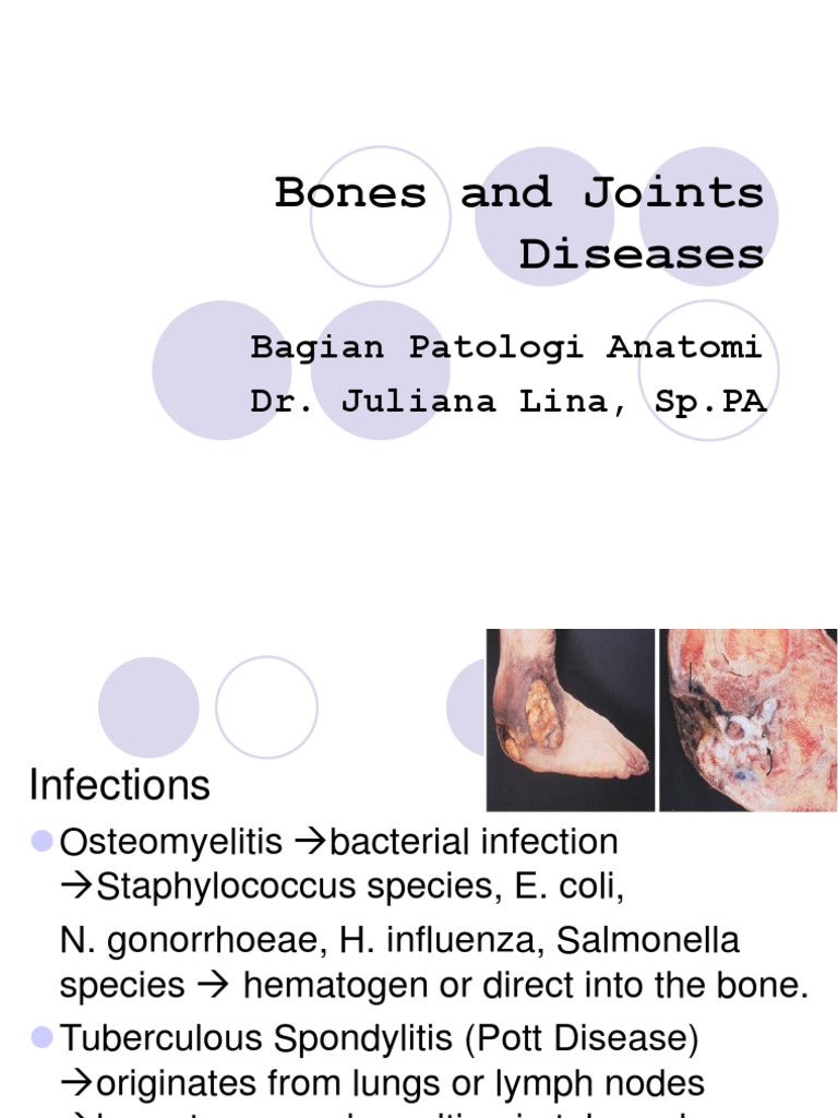 Bones and Joints Diseases: Bagian Patologi Anatomi Dr. Juliana Lina, SP ...