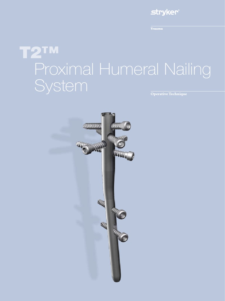 Proximal Humeral Nailing System: Operative Technique