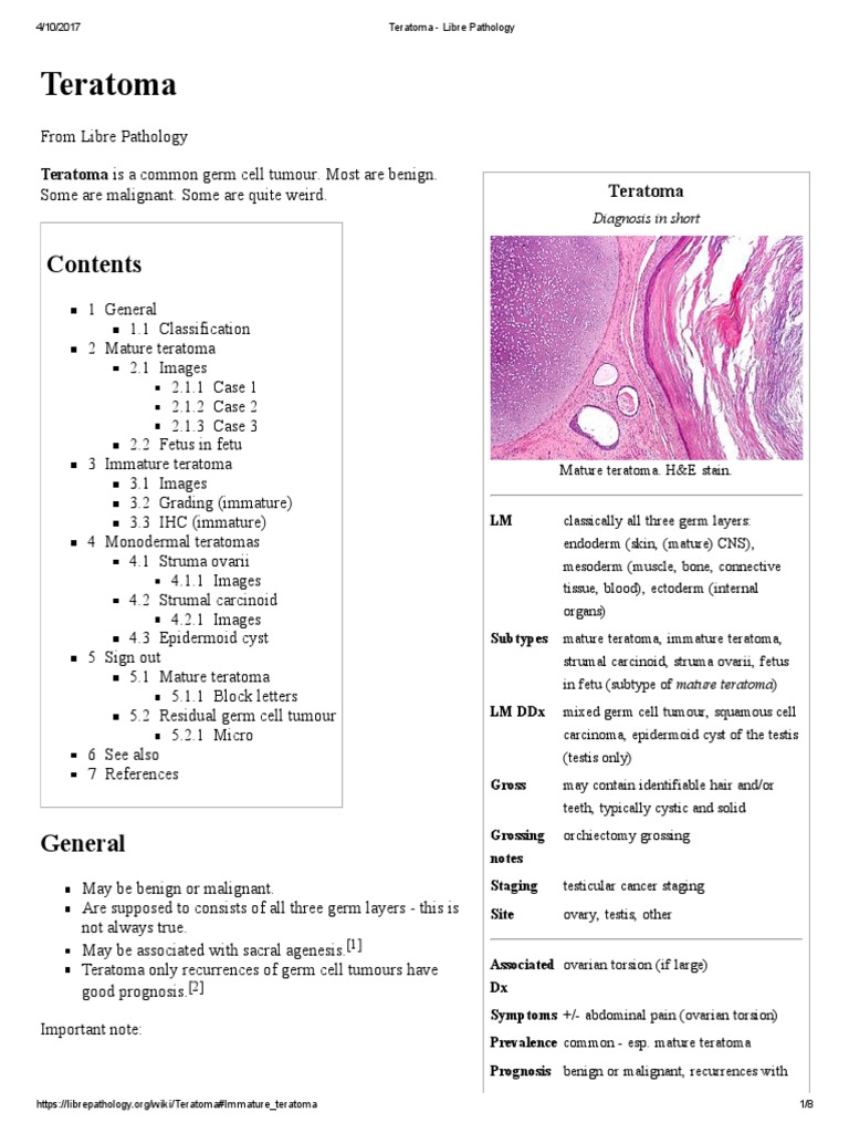 Teratoma Pathology Overview | PDF | Ovarian Cancer | Cancer
