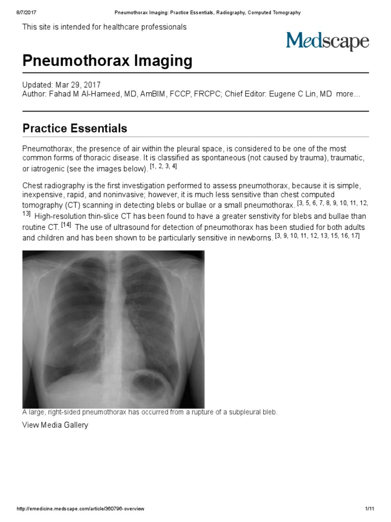 4.pneumothorax Imaging - Practice Essentials, Radiography, Computed ...