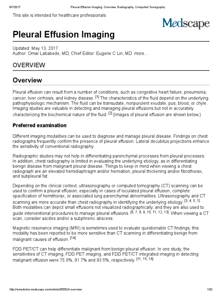 3.pleural Effusion Imaging - Overview, Radiography, Computed Tomography ...