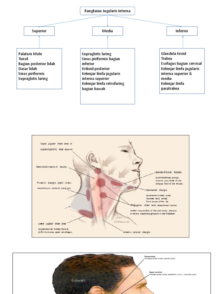 Anatomi Limfadenopati | PDF