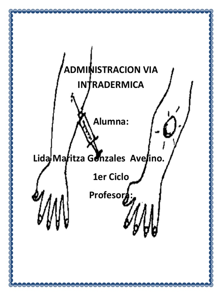 Administracion Via Intradermica | Inyección (medicina) | Medicamentos ...