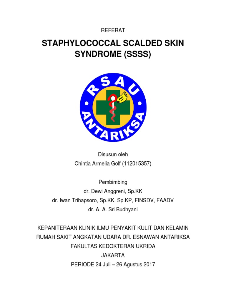 Ssss | PDF
