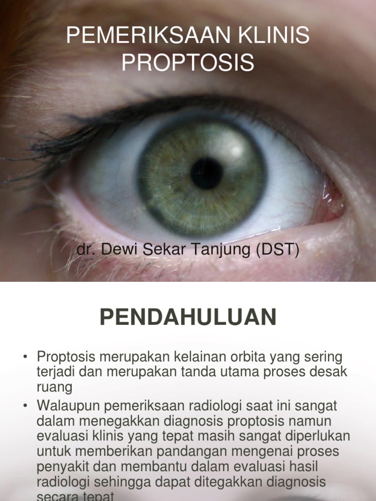 Pemeriksaan Proptosis | PDF