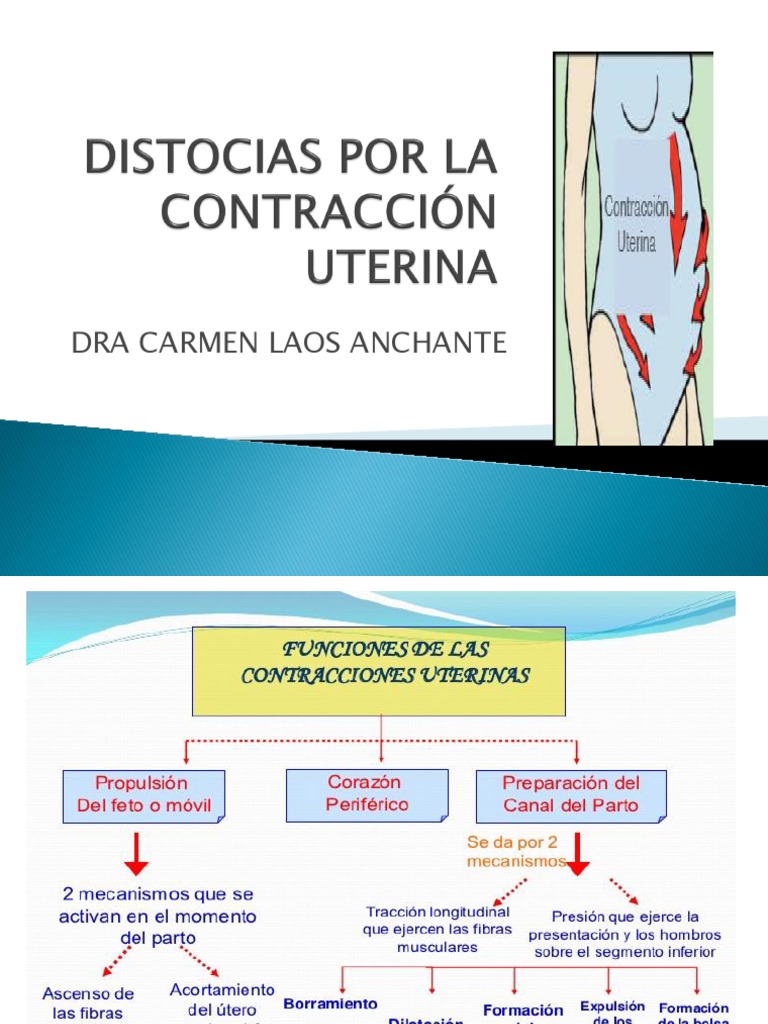 Distocias Por La Contracción Uterina | Parto | Ciencias de la Salud