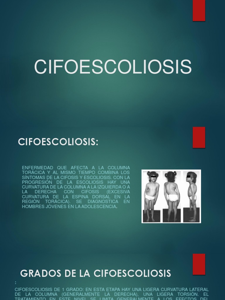CIFOEScoliosis. | Naturaleza | Prueba gratuita de 30 días | Scribd