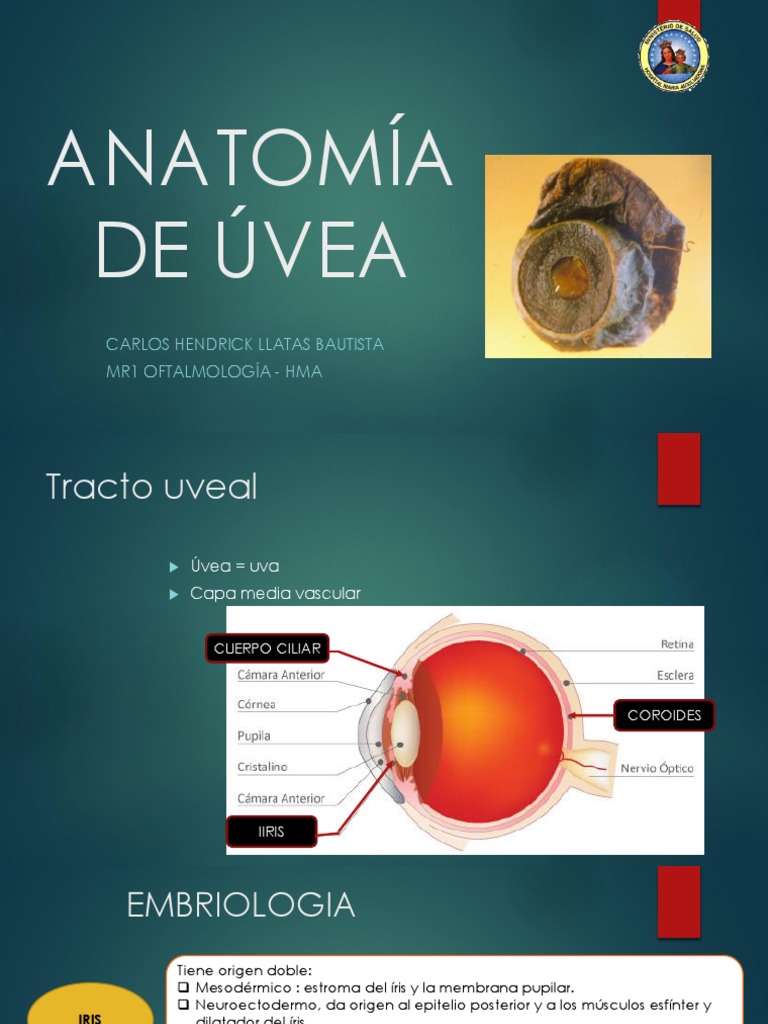 Expo Anatomia de Uvea | PDF | Epitelio | Tejido conectivo