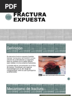 Cerclaje de Rótula: Técnica Quirúrgica | PDF | Articulación | Rodilla