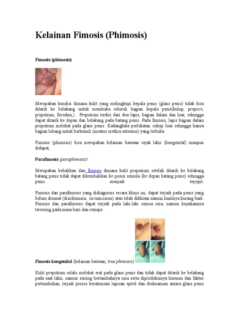Phimosis | PDF