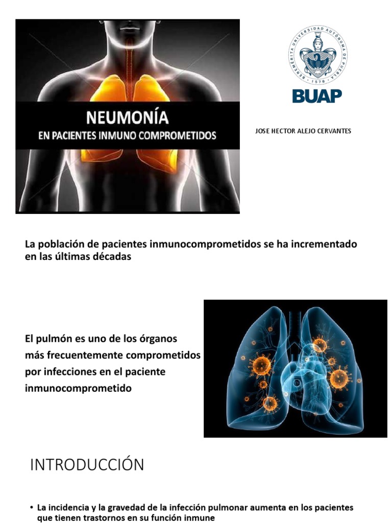 Neumonia en Inmunocomprometidos | PDF | VIH | Infección