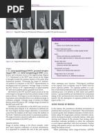Thumb and MCP Goniometry Guide | PDF