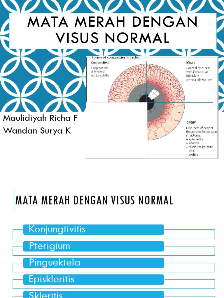 Mata Merah Visus Normal | PDF