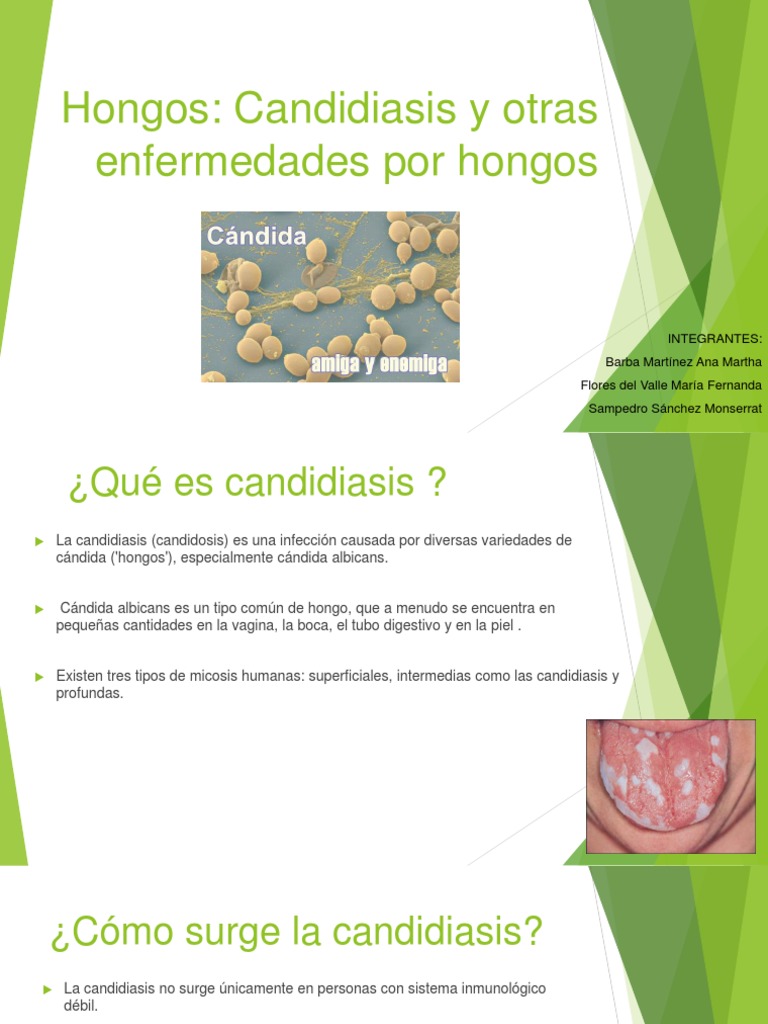 Candidiasis bucal e infecciones por hongos: candidiasis oral contagiosa ...