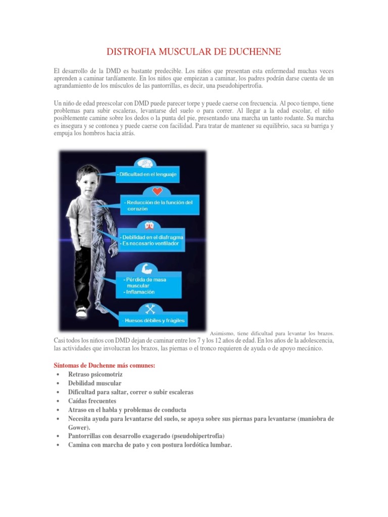 Distrofia Muscular de Duchenne | PDF | La columna vertebral | Pie