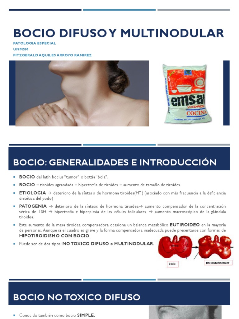 Tipos de Bocio: Difuso y Multinodular | PDF | Tiroides | Hormona ...
