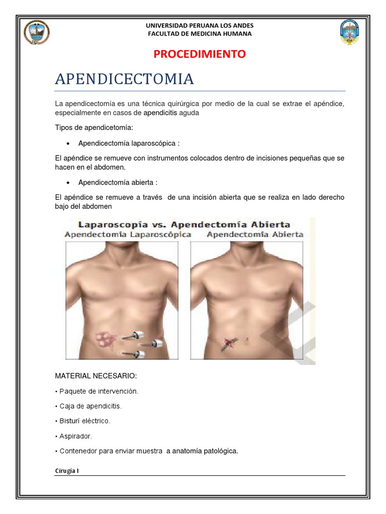 Apendicectomia | PDF | Cirugía | Especialidades Medicas