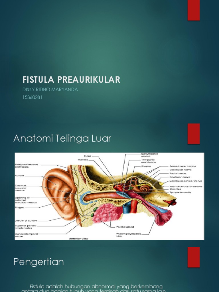 Fistula Preaurikular | PDF | Sains & Matematika