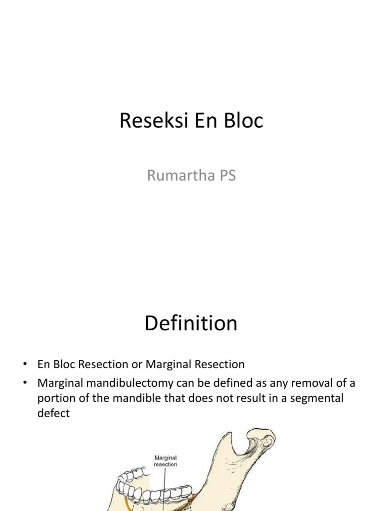 A Guide to En Bloc Resection of the Mandible: Indications, Techniques ...