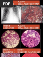 Cápsula de Glisson | PDF | Tejido adiposo | Riñón