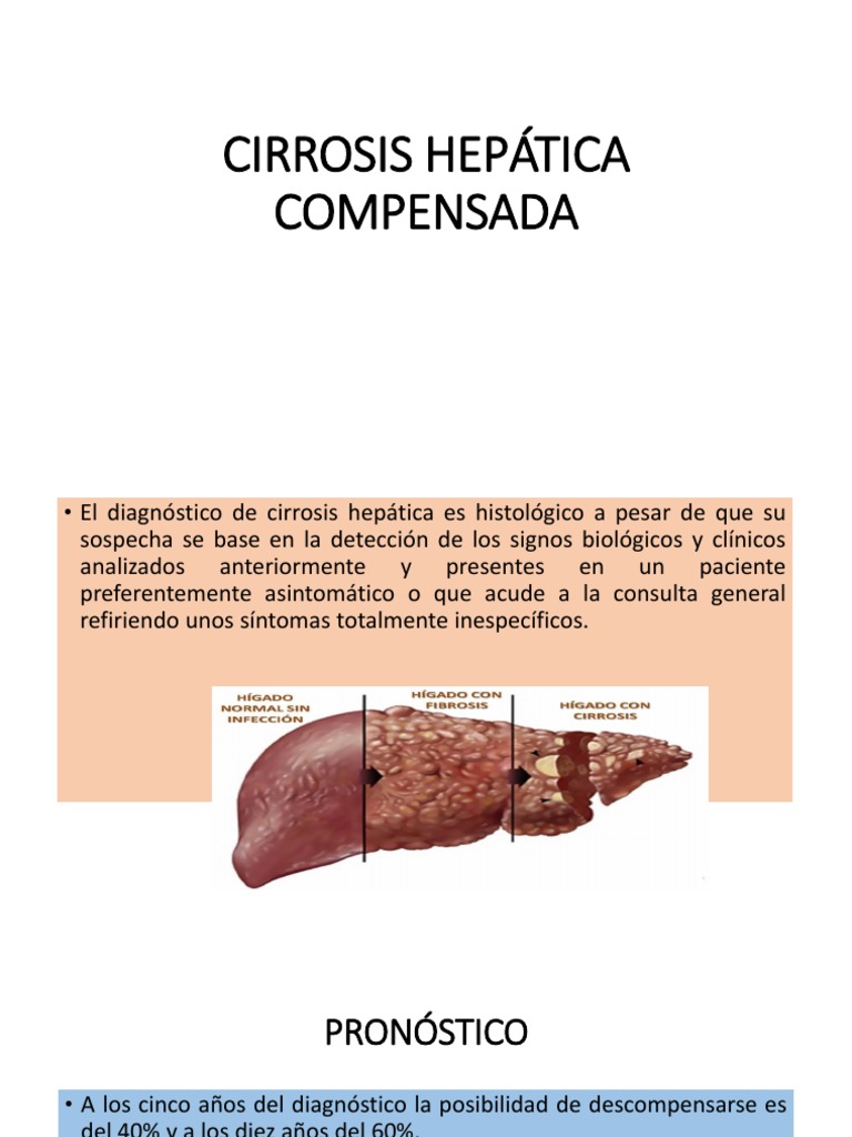 Cirrosis Hepática Compensada | PDF