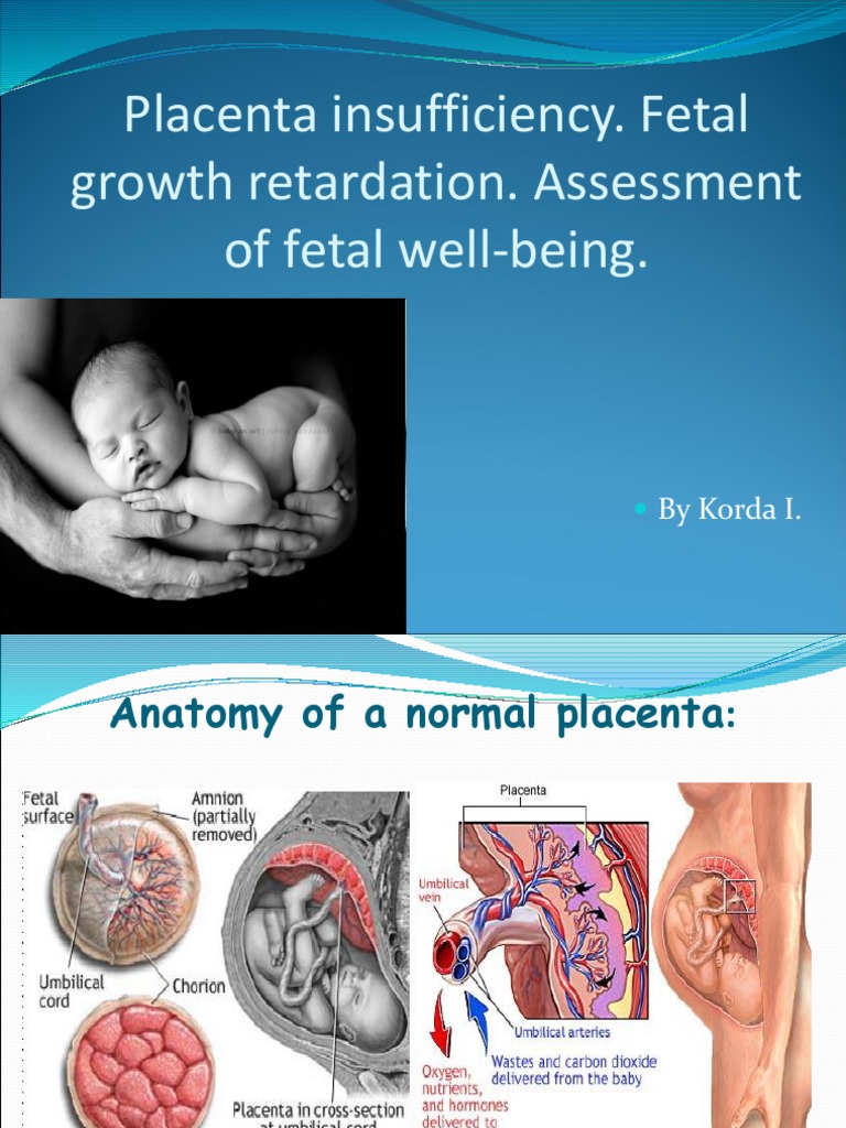Placenta Insufficiency | PDF | Fetus | Placenta