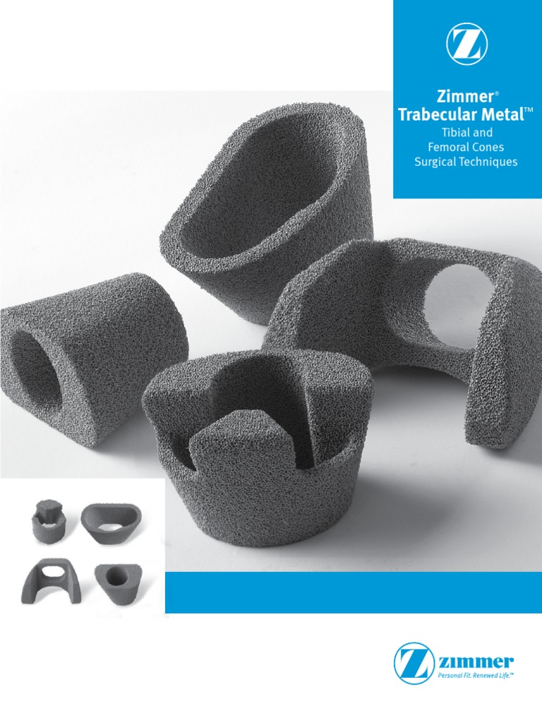 Zimmer Trabecular Metal Tibial Cone Surgical Technique | Dental Implant ...