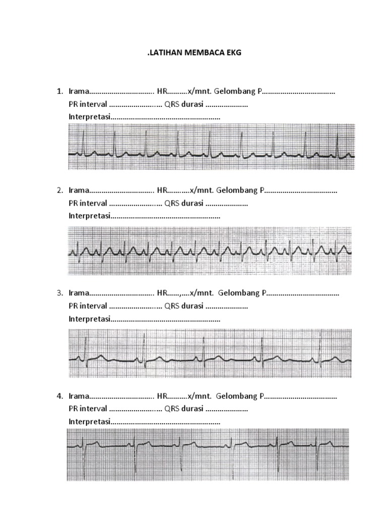 Latihan Membaca Ekg | PDF