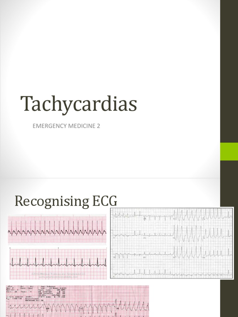 ACLS For Tachycardia | PDF | Cardiovascular System | Cardiovascular ...
