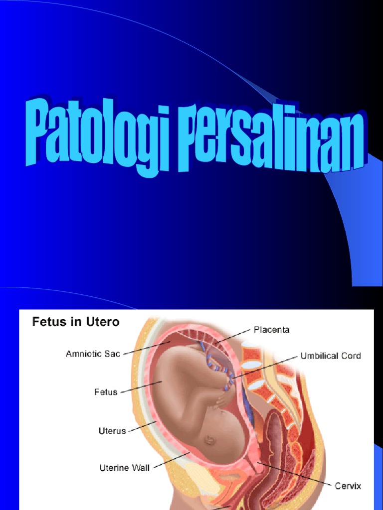 Patologi Persalinan | PDF