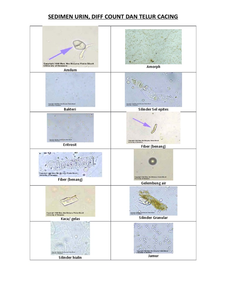 Daftar Sedimen Urin, Telur Cacing. Dan Diff Count | PDF