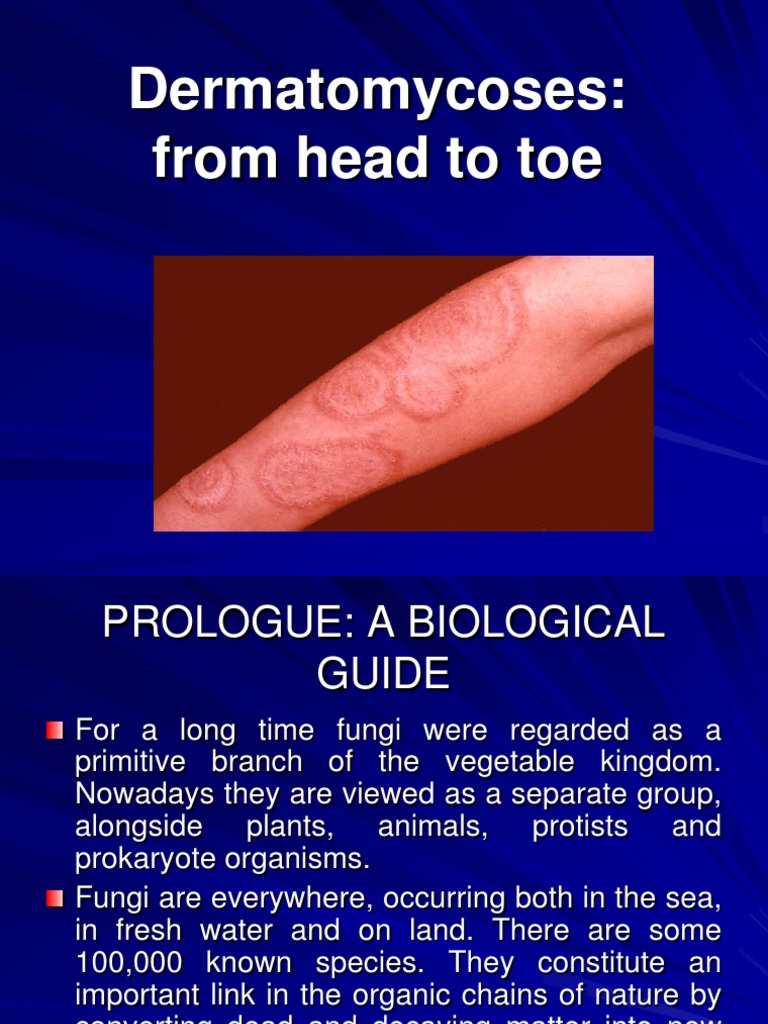 Dermatomycoses | Candidiasis | Candida (Fungus) | Free 30-day Trial ...