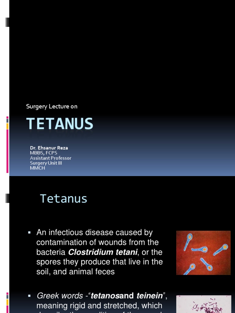 Tetanus.ppt | Medical Specialties | Clinical Medicine