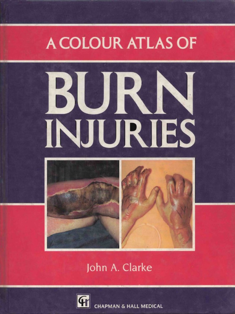 Colour Atlas of Burn Injuries-CHAPMAN & HALL MEDICAL PDF | PDF
