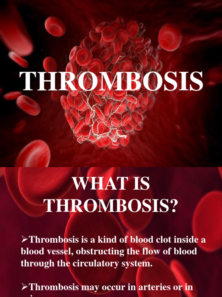 Thrombosis And Haemostasis Research