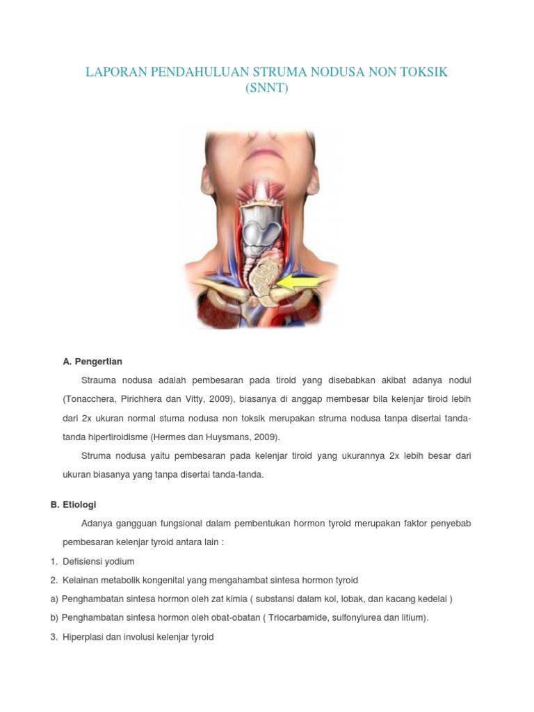 Laporan Pendahuluan Struma Nodusa Non Toksik | PDF