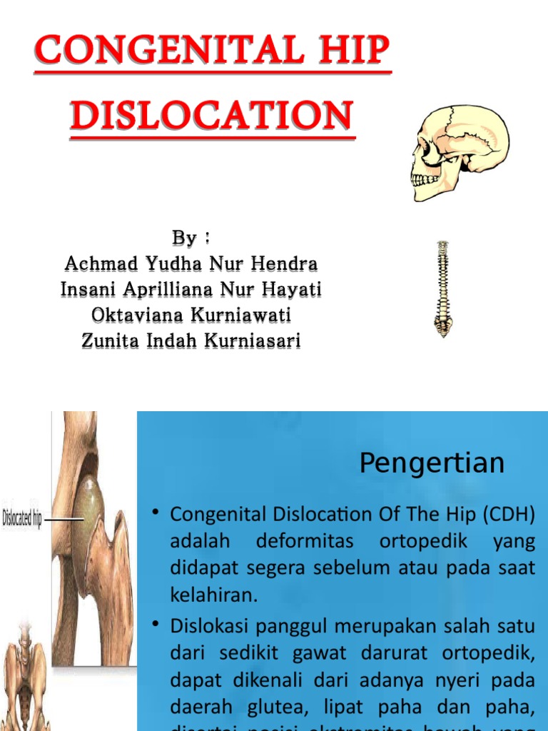 Congenital Hip Dislocation | PDF