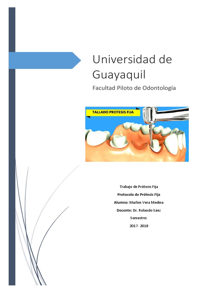 Protocolo de Protesis Fija | PDF | Dentadura postiza | Yeso