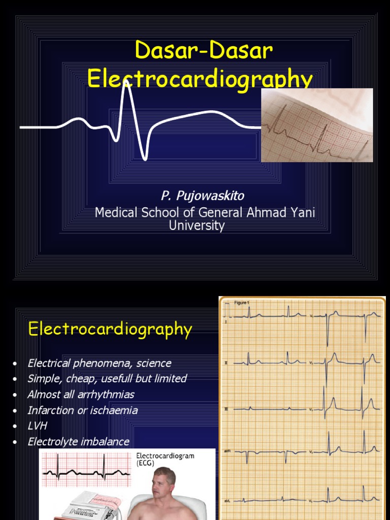 Materi Dasar Ekg | PDF | Electrocardiography | Circulatory System