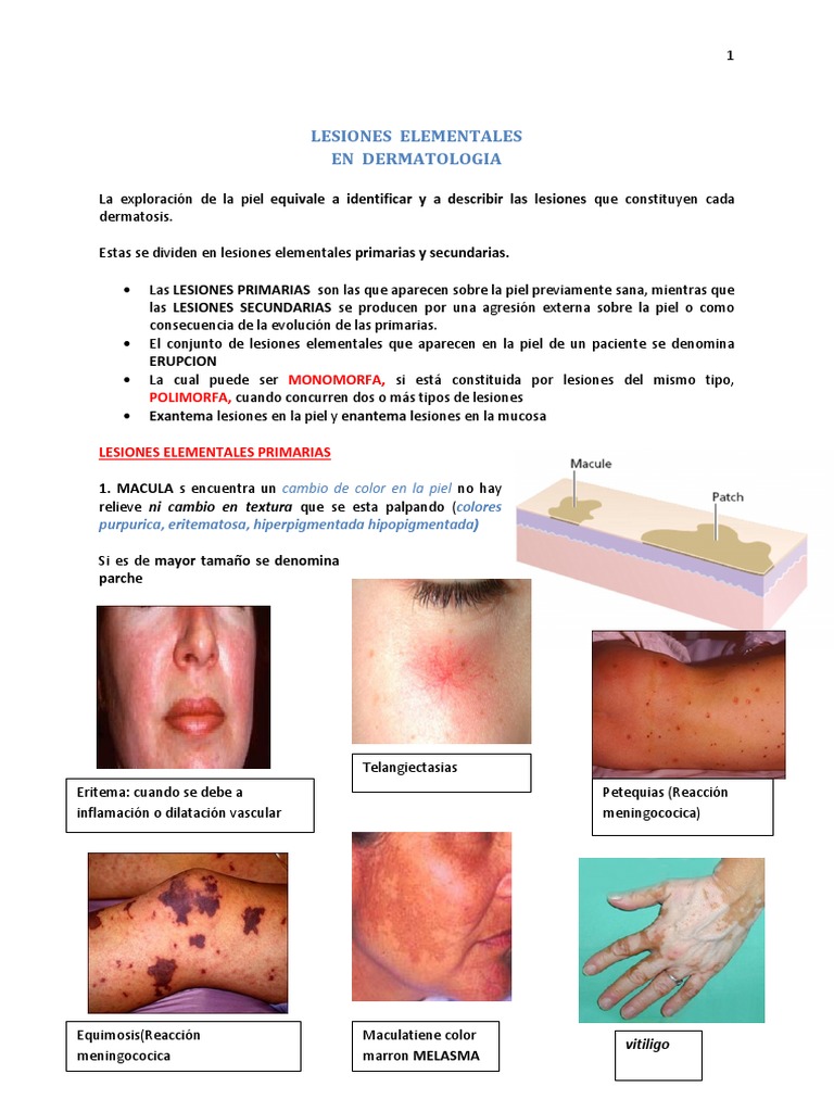 Lesiones Elementales | PDF | Piel | Atrofia