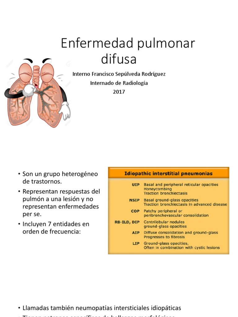 Enf. Pulmonar Difusa - Enfermedad Pulmonar Intersticial TAC | PDF | Neumonía | Epidemiología