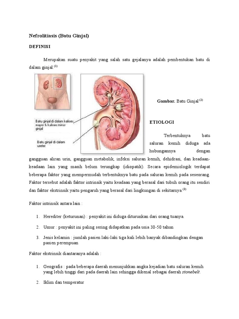 Nefrolitiasis | PDF