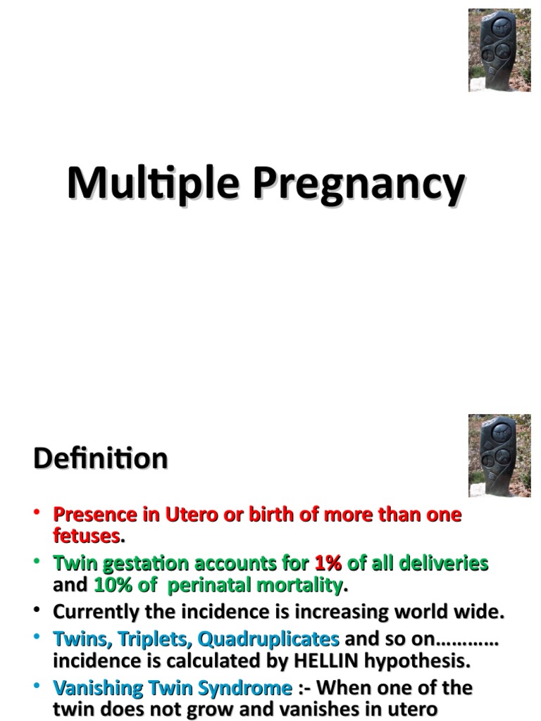 Multiple Pregnancy 2008 | PDF | Twin | Multiple Births
