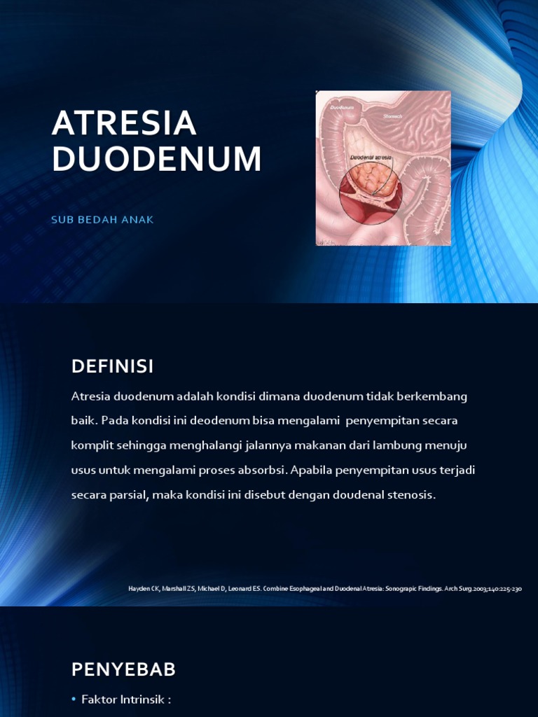 Atresia Duodenum | PDF