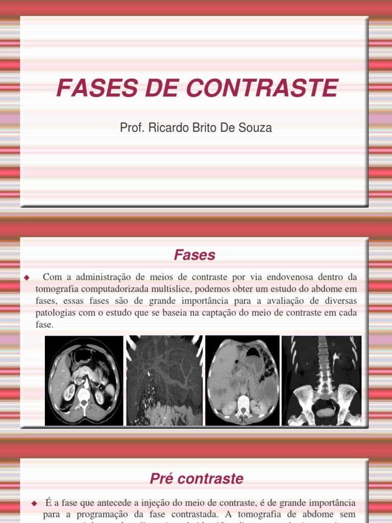Fases de Contraste 1-1 | PDF | Sistema circulatório | Artéria