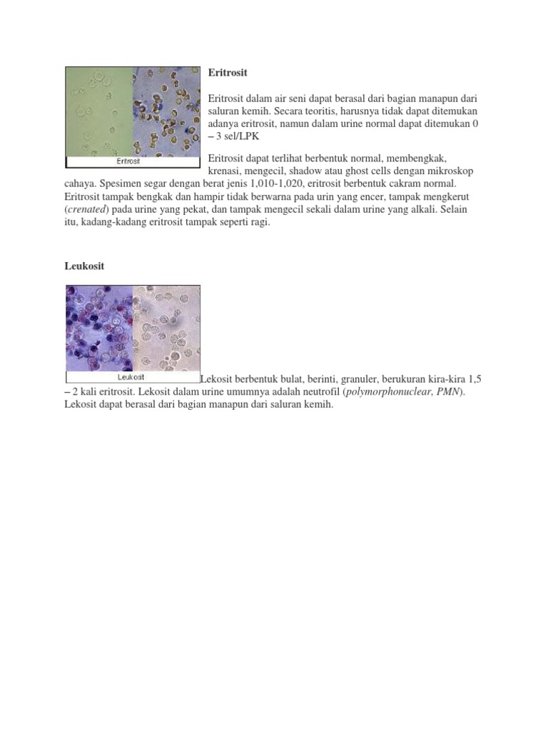 Sedimen Urin | PDF