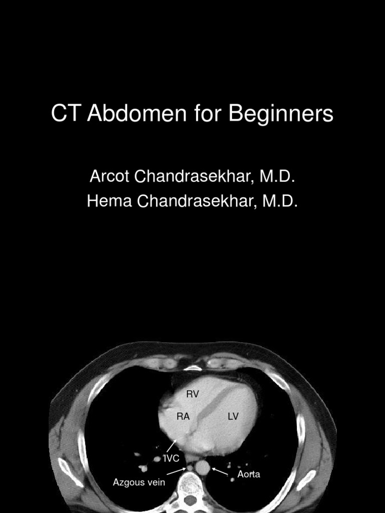 A Comprehensive Guide to CT Abdomen Anatomy for Beginners | PDF