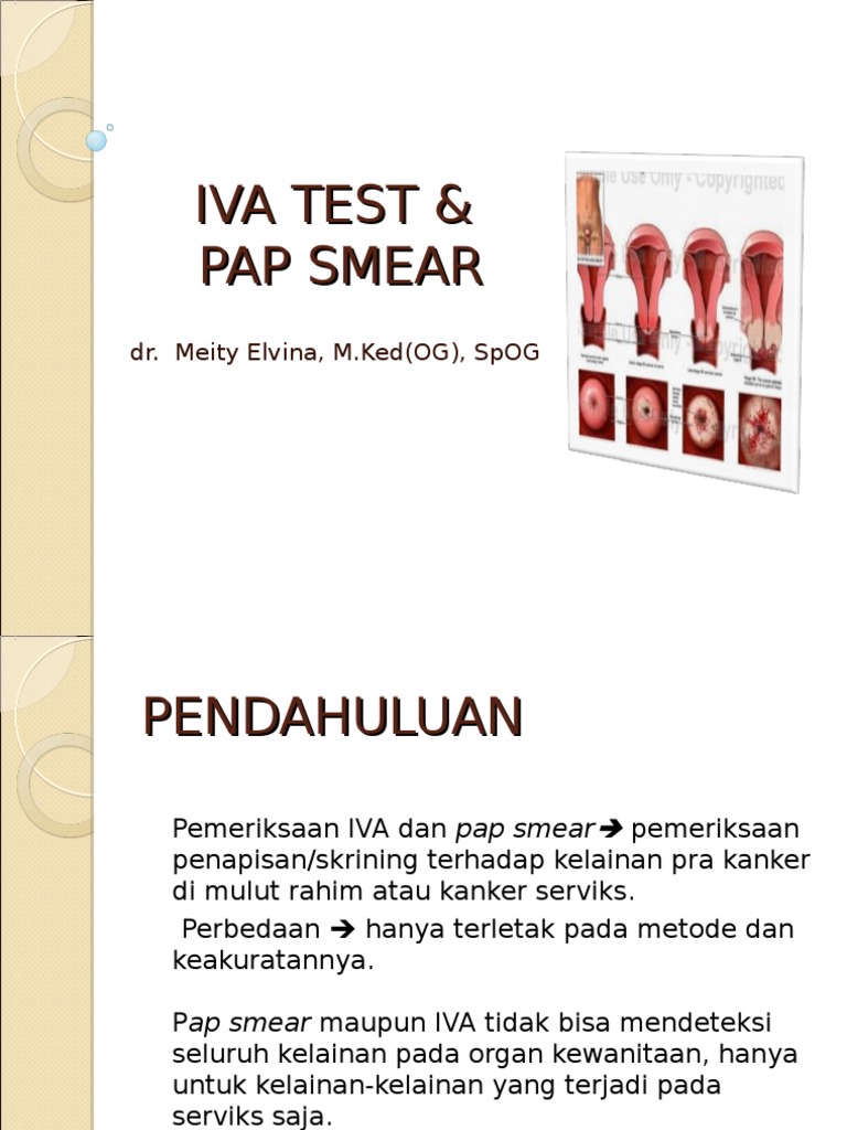 Iva Test & Pap-Smear | PDF