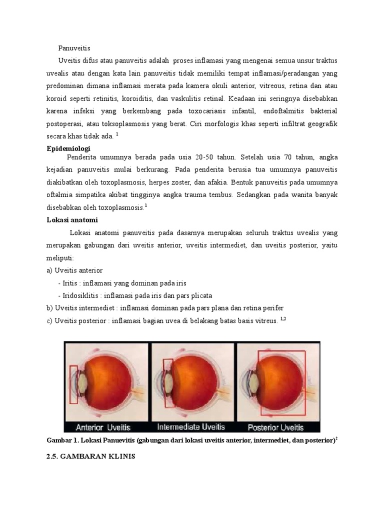 Panuveitis | PDF